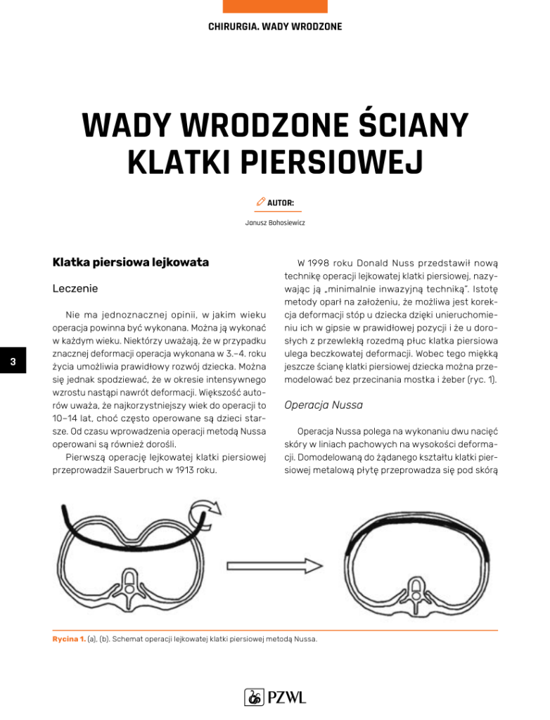 Chirurgia - wady wrodzone - Darmowe e-booki PZWL